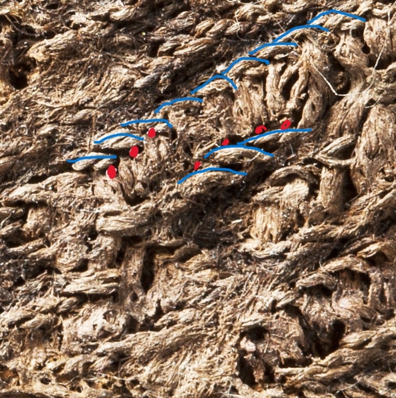 Different Types of Needles for Specific Uses? Experimental ...