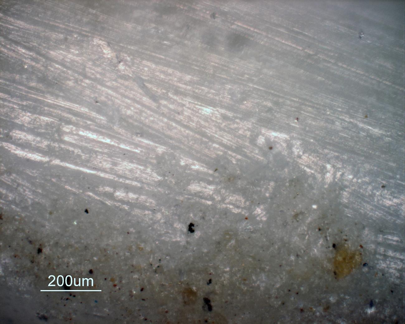 Different Types of Needles for Specific Uses? Experimental ...